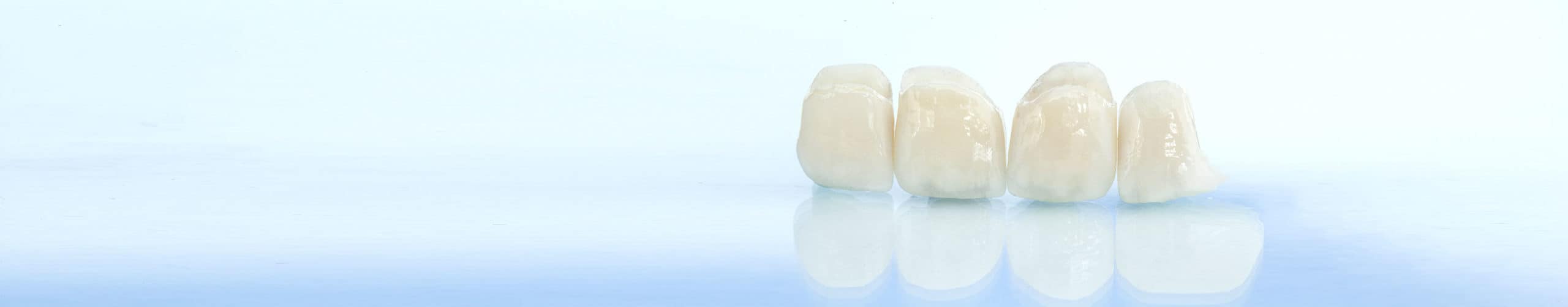 All Ceramic Dental Crowns | All Ceramic Crown Preparation
