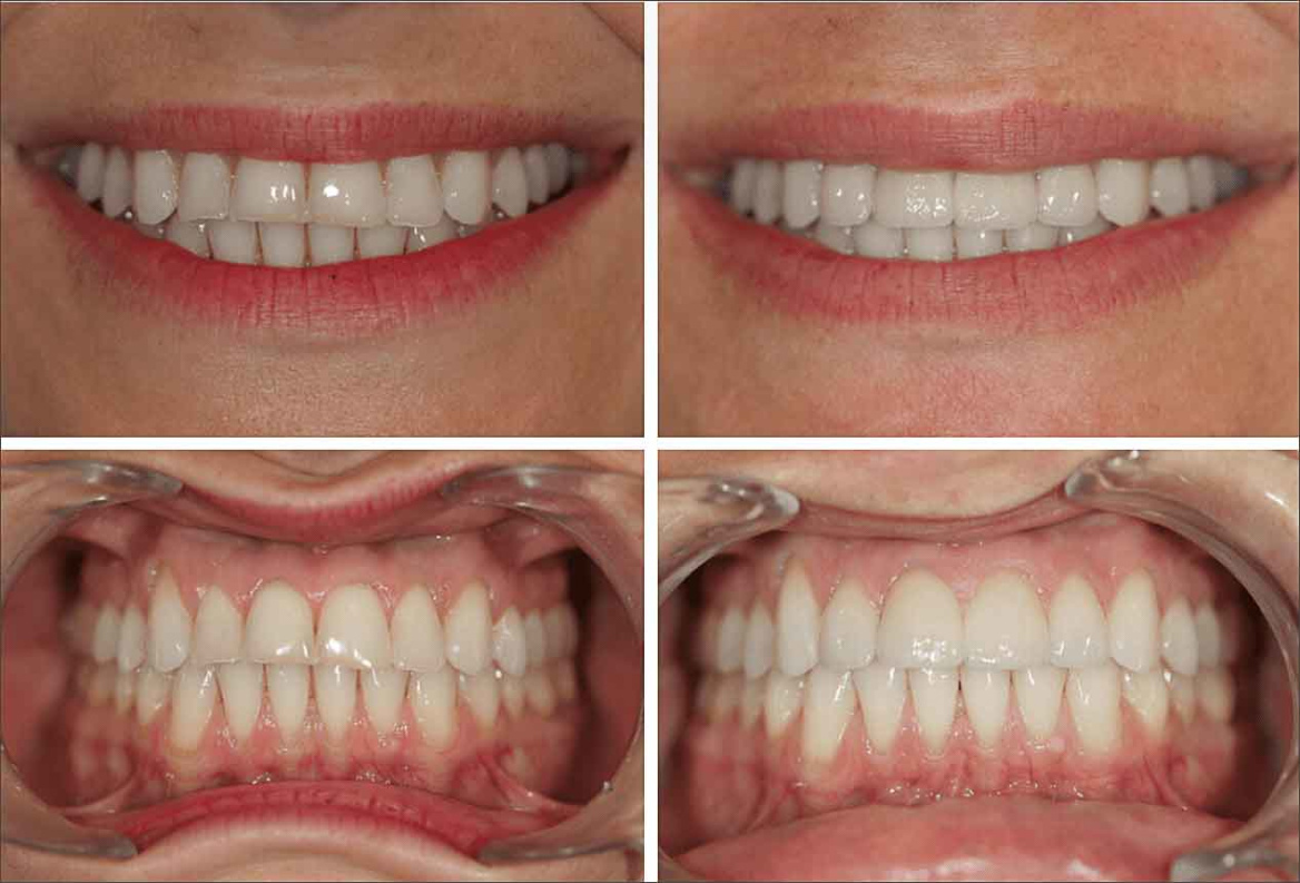 Best Dentist in Fort Lauderdale | Stanton Smiles